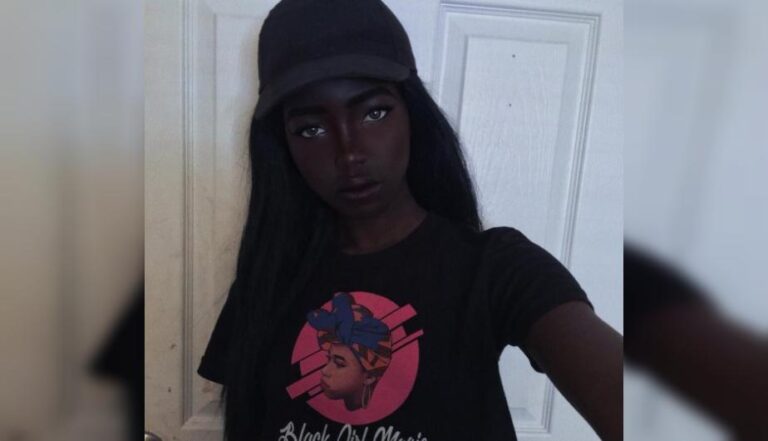 Lola Chuil è la bimba nata con la pelle più scura del mondo, oggi è una ...