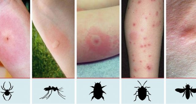 Ti ha punto un insetto e non sai di quale si tratta? Qui ti diciamo ...