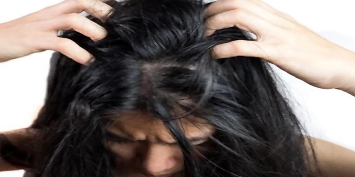 Cause e rimedi naturali contro il fastidioso prurito in testa